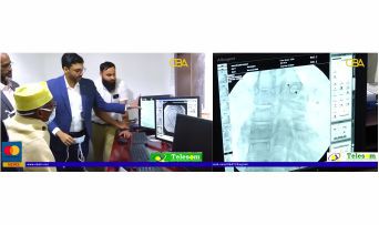 Mobile Cath Lab Machine Manufacturers | Allengers Photon Cathlab